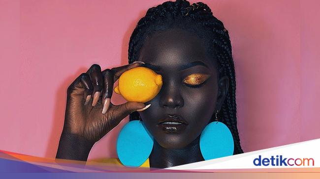 Potret Model Hitam Legam, Dulu Tinggal di Pengungsian Kini Berharta Rp 63 M