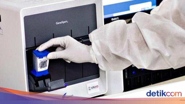 RI Kerahkan Alat Tes TBC untuk Tes Corona, 45 Menit Keluar Hasilnya
