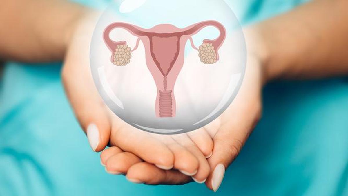 7 Cara Mengobati Kista Ovarium secara Alami, Cukup di Rumah
