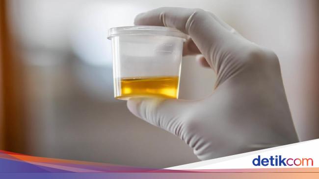 Kateter Urine: Fungsi dan Jenis-jenisnya