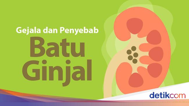 Perlu Tahu! Gejala dan Penyebab Penyakit Batu Ginjal Perlu Tahu! Gejala dan Penyebab Penyakit Batu Ginjal