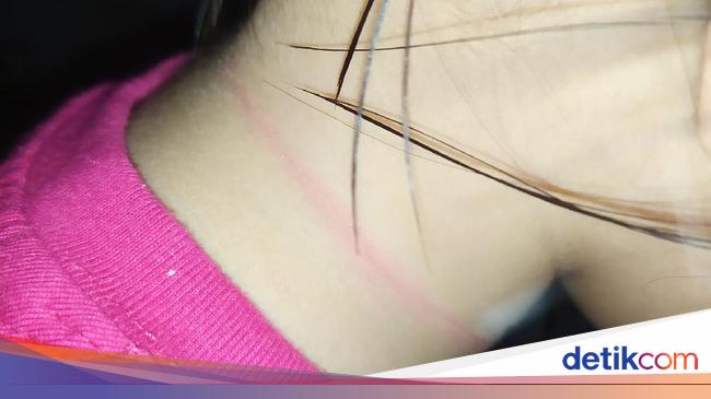 Anaknya Hampir Tewas karena Main TikTok, Ibu Ini Beri Peringatan di Medsos