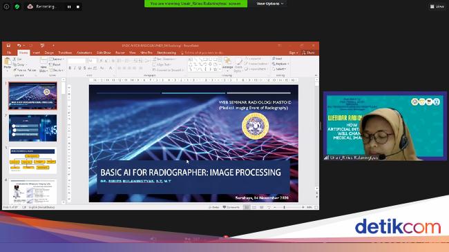 Manfaat Kecerdasan Buatan Bagi Profesi Radiografer