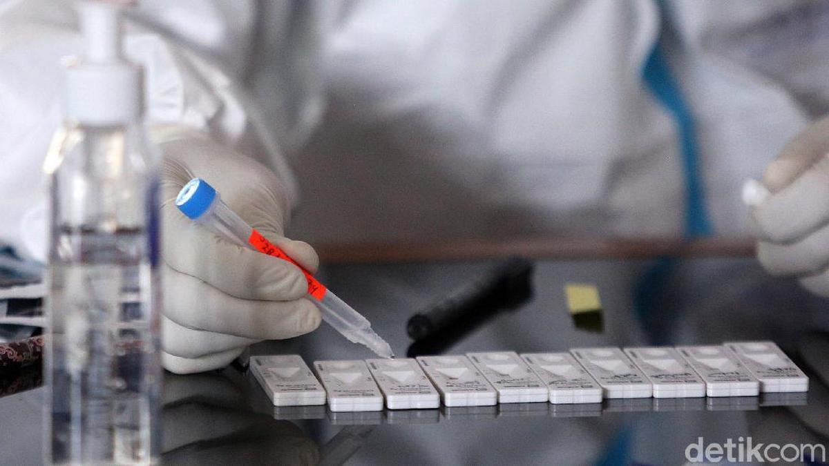 Cara Pemeriksaan Rapid Antigen, Perlu Tahu Biar Nggak Deg-degan!