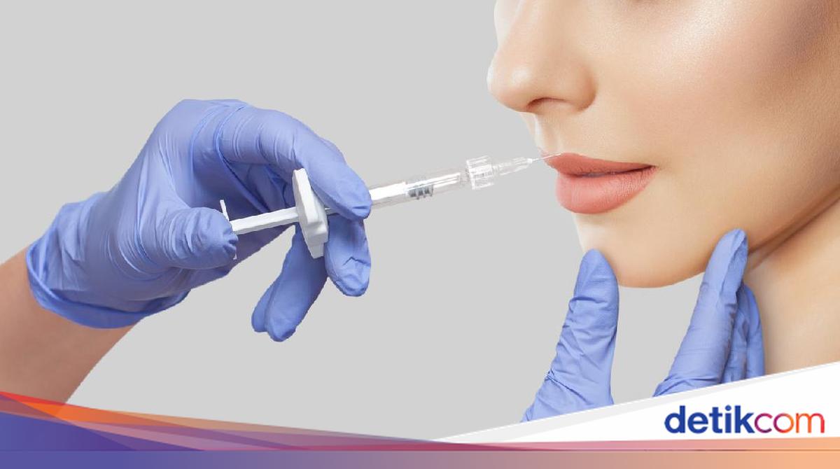 Botox Bibir Jadi Tren Viral, Dokter Kecantikan Ungkap Risikonya