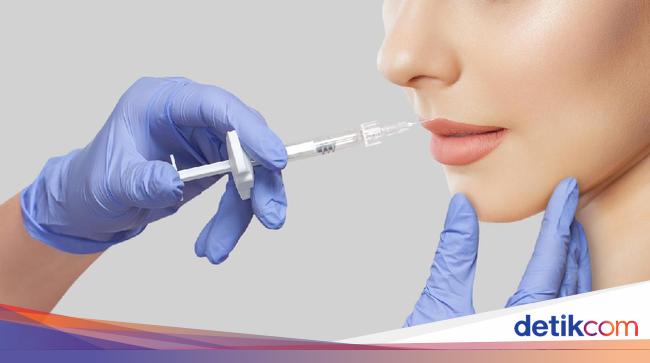Botox Bibir Jadi Tren Viral, Dokter Kecantikan Ungkap Risikonya