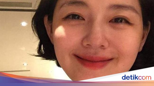 Barbie Hsu 'San Chai Meteor Garden' Meninggal di Usia 48, Ini Kata Keluarga