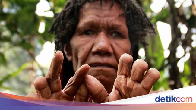 Potong Jari & Daun Telinga, Inilah Tradisi Unik Suku Dani