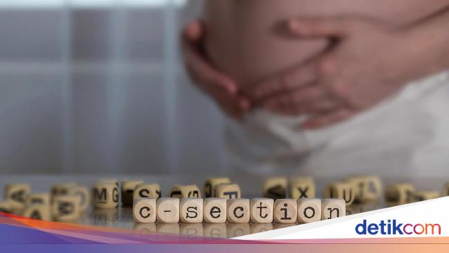 Operasi Caesar: Definisi, Proses, Efek Samping hingga Proses Pemulihan