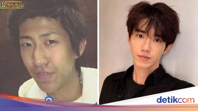 5 Artis Korea yang Operasi Plastik, Ini Foto Sebelum dan Sesudahnya