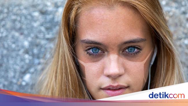 15 Cara Menghilangkan Belang di Wajah dengan Bahan Alami, Praktis Banget!