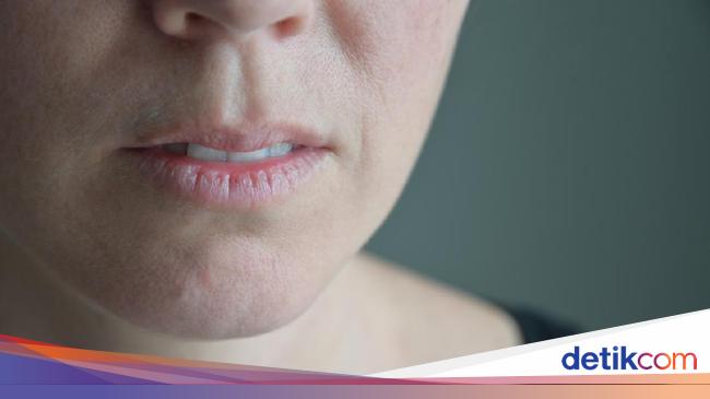 Bibir Pecah-pecah Meski Sering Minum? Mungkin Ini Penyebabnya