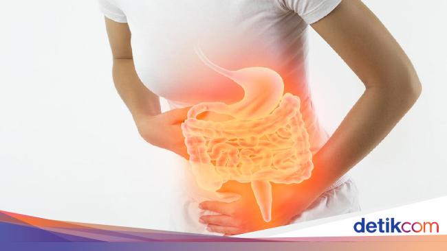 4 Makanan untuk Menyehatkan Usus yang Perlu Dikonsumsi Rutin