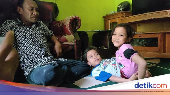 Menengok Aktivitas Bocah Kembar Siam Dempet Perut di Garut