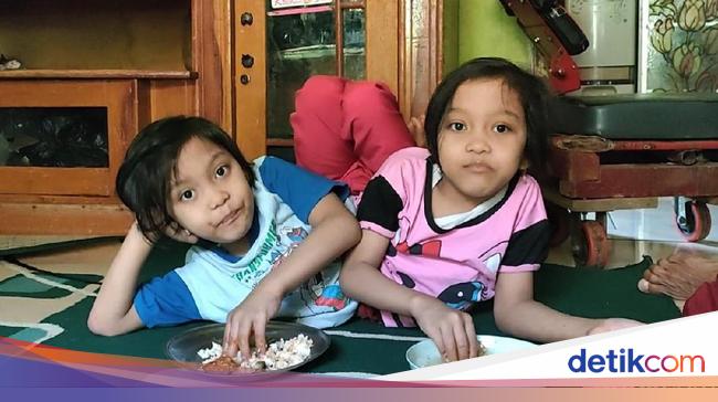 Cerita Bocah Kembar Siam Dempet Perut yang Ingin Jadi Ilmuwan dan Artis