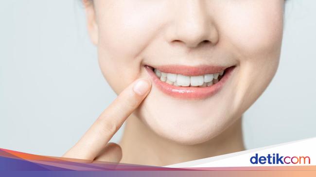 5 Cara Memperbaiki Gigi Berlubang dan Penyakit yang Timbul Jika Tak ...