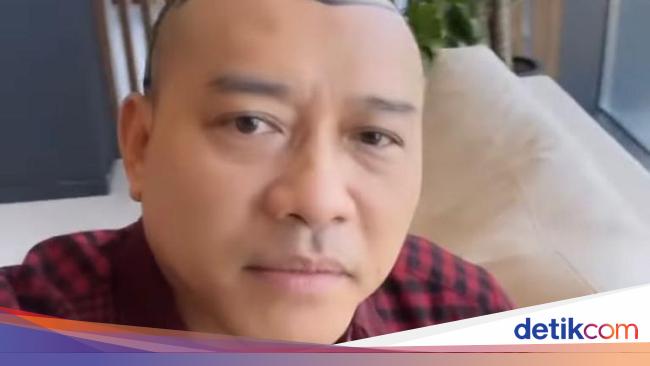 7 Gaya Baru Anang Hermansyah Dengan Rambut Botak, Disebut Mirip Raul Lemos