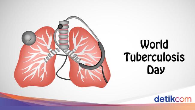 Hari Tuberkulosis Sedunia 2022: Sejarah dan Temanya