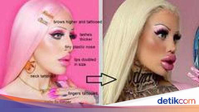 Perubahan Drastis Wanita Terobsesi Jadi Barbie, Tak Dikenali Setelah 3 ...
