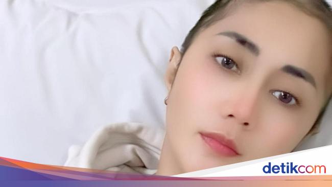 Potret Aida Saskia yang Berjuang Melawan Kanker Payudara