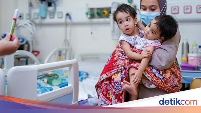 Bayi Kembar Siam Sukabumi Jalani Operasi Pemisahan di RSHS