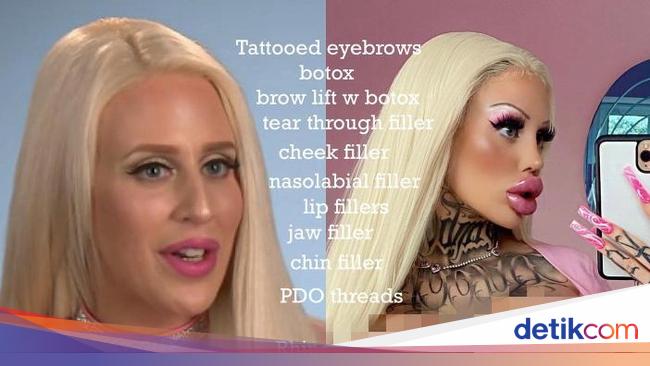 Penampilan Wanita yang Obsesi Oplas, Dulu 'Normal' Kini Mirip Boneka Seks