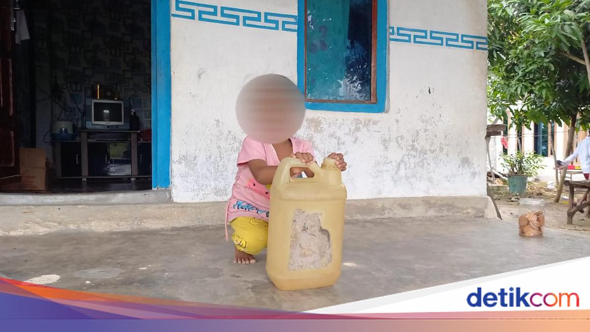 Balita di Sampang Kecanduan Hirup Bau Bensin, Efeknya Kerusakan Saraf ...