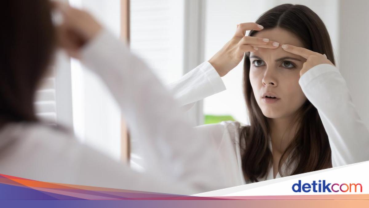 Ketahui Ciri-ciri Jerawat Pustula, Penyebab, dan Cara Mengobatinya
