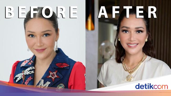 10 Potret Maia Estianty Sebelum vs Sesudah Laser-Botox
