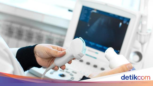Digunakan untuk Diagnosis Penyakit, Ini Kegunaan X Ray, USG, CT Scan ...