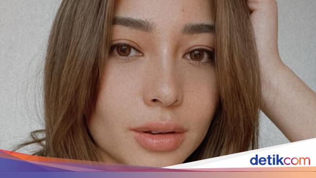 Nikita Willy Alami Brain Fog Semenjak Jadi Ibu, Efeknya Begini