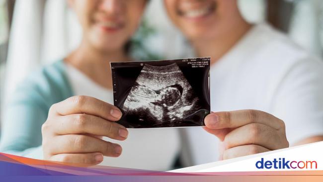 Bunda, Inilah Cara Membaca Hasil USG yang Wajib Diketahui!