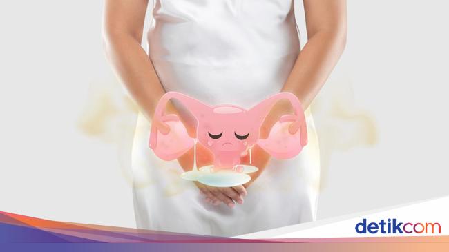 Inilah Penyebab Keputihan Berwarna Coklat dan Cara Mengatasinya