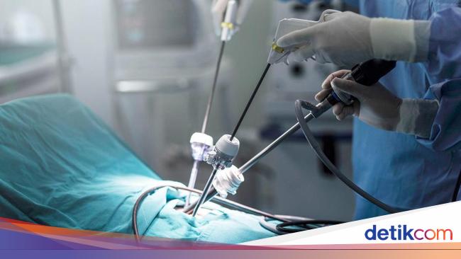 Jenis Operasi yang Ditanggung dan Tidak Ditanggung BPJS Kesehatan Jenis Operasi yang Ditanggung dan Tidak Ditanggung BPJS Kesehatan