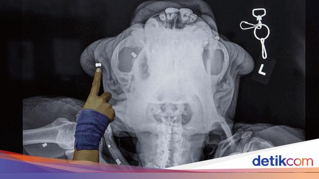 Deretan Foto X-Ray yang Bikin Merinding