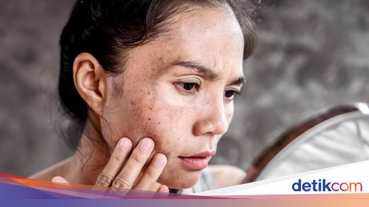 Apa Itu Purging? Ciri, Penyebab, dan Cara Pencegahannya