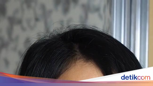 MUA Viral Imitates Ferdy Sambo's Wife's Style, Makeup Results Surprise ...