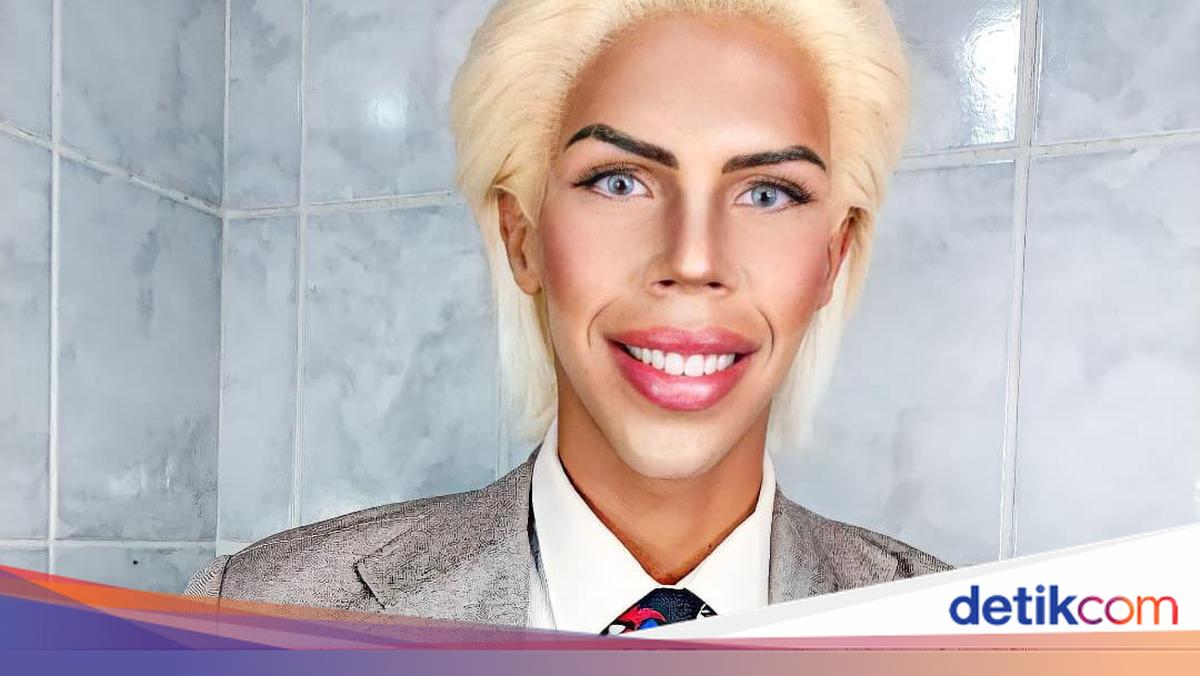 Transformasi Pria yang Dulu Terobsesi Mirip Boneka Ken, Kini Jadi ...