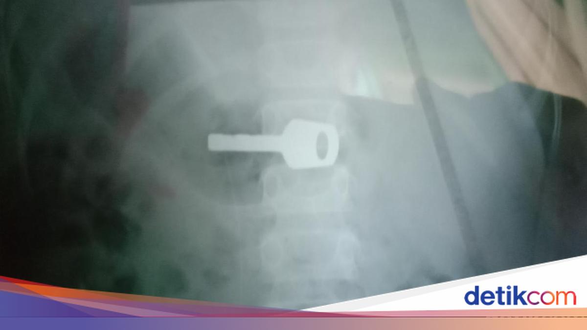 Zul Merintih Kesakitan Saat Kunci Gembok Masuk ke Perutnya