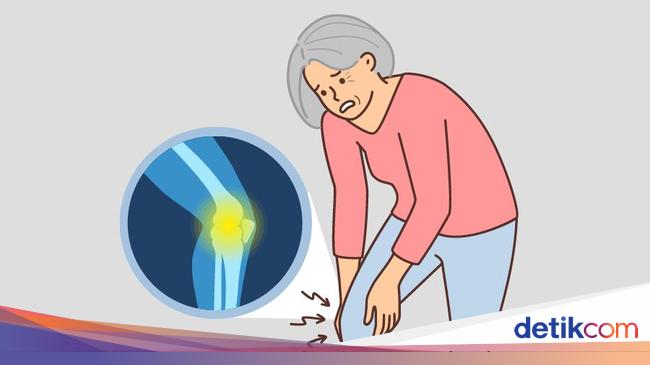 Hari Radang Sendi Sedunia, Yuk Kenali Gejala Osteoarthritis