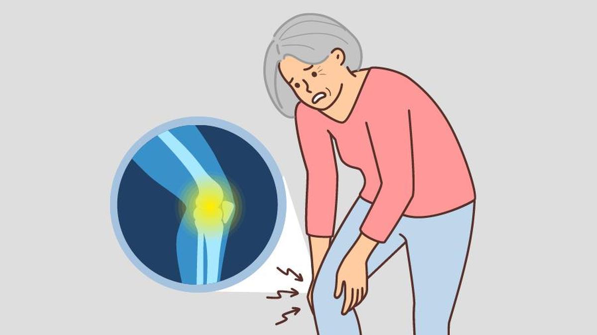Hari Radang Sendi Sedunia, Yuk Kenali Gejala Osteoarthritis