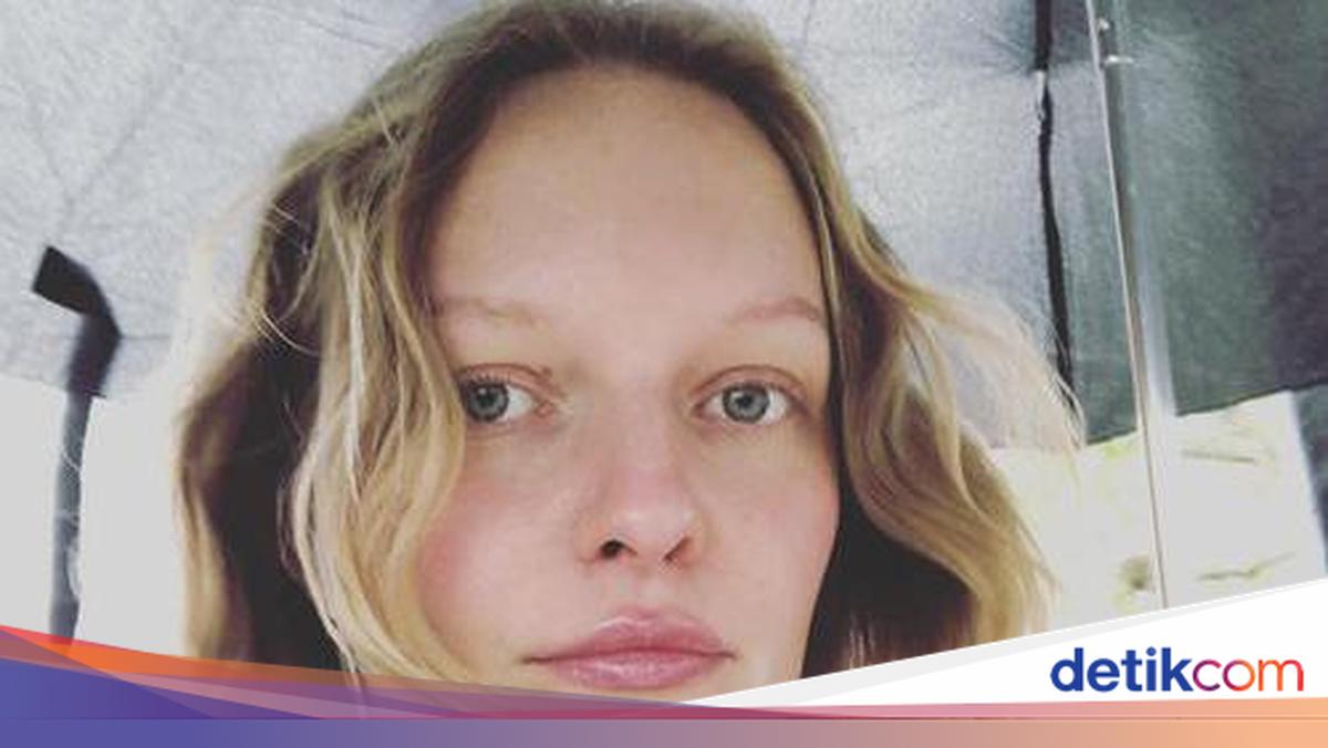 Mantan Model Gucci Jadi Aktivis, Bantu Bawa Kabur Orang dari Rusia
