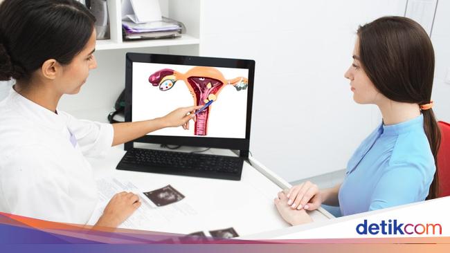 Miom Adalah Tumor Jinak Di Dinding Rahim Kenali Penyebab Dan Pengobatannya