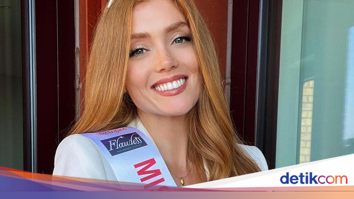 10 Pesona Jessica Gagen, Miss England Pertama yang Berambut Asli Merah
