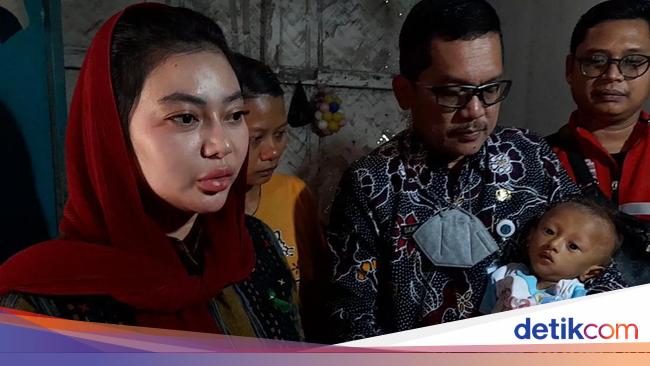 Divonis Gizi Buruk Berat, Balita Kurus di Brebes Dievakuasi ke RSUD