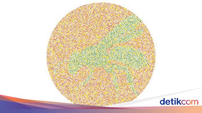 Tes Buta Warna Super Mudah! Tak Bisa Tebak, Harus Segera Cek ke Dokter