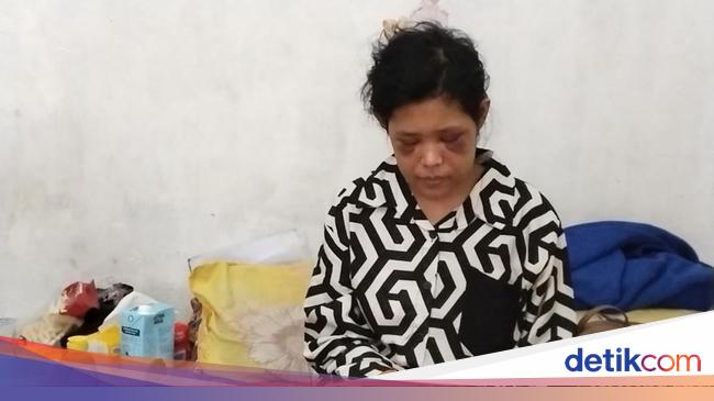 Luka Fisik dan Batin Rohimah Usai Disiksa Majikan