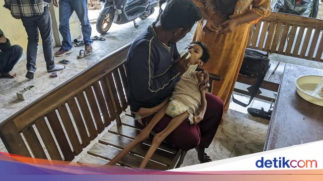 Belasan Tahun Terbaring Lemas di Tempat Tidur, Remaja Ini Butuh Bantuan