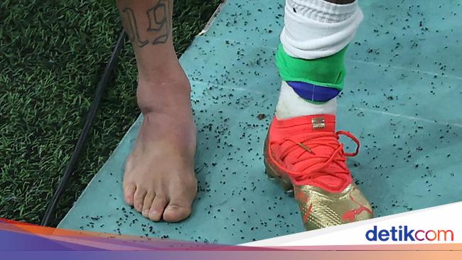 Viral Penampakan Kaki Neymar Bengkak gegara Cedera Engkel