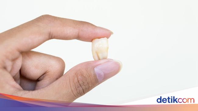 10 Arti Mimpi Gigi Copot Semua, Pertanda Baik atau Buruk?